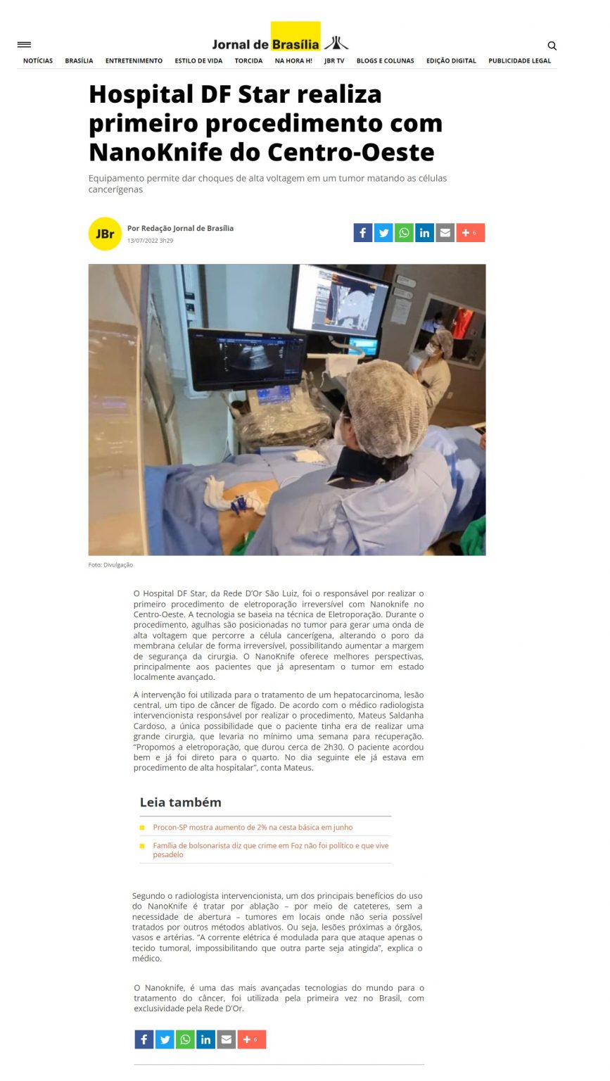 Jornal de Brasília - Hospital DF Star realiza primeiro procedimento com ...